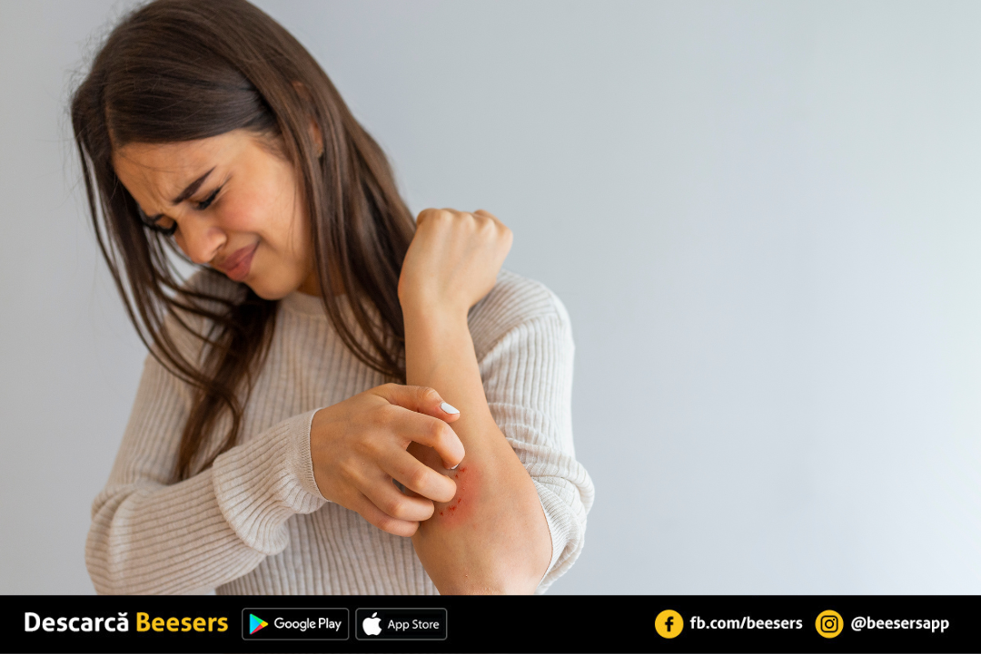 Cele mai frecvente boli de piele - cum le depistăm, când ne alarmăm ...